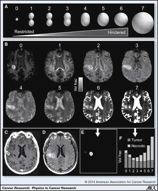 Diffusion-Weighted Imaging in Cancer: Physical Foundations and ...