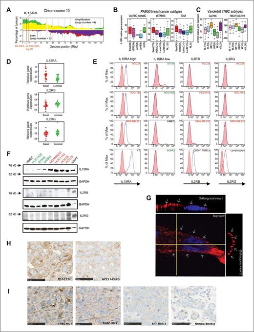 IL15RA Drives Antagonistic Mechanisms of Cancer Development and Immune ...
