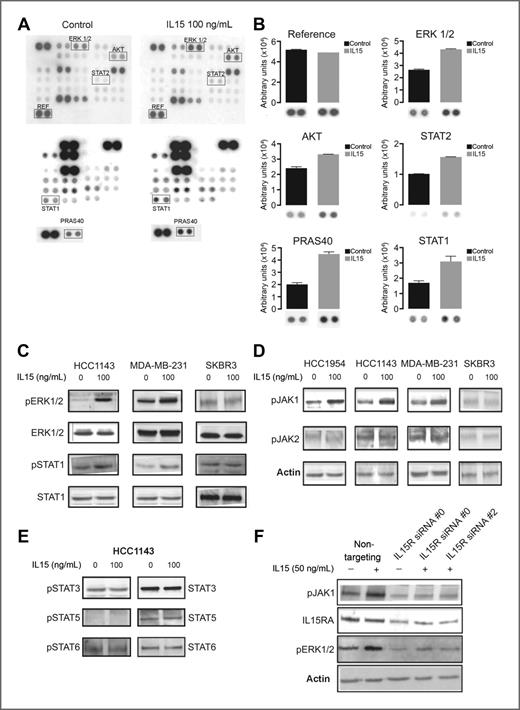 IL15RA Drives Antagonistic Mechanisms of Cancer Development and Immune ...