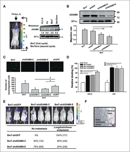 ADAM9 Promotes Lung Cancer Metastases to Brain by a Plasminogen ...