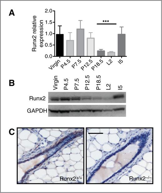 Runx2 Is a Novel Regulator of Mammary Epithelial Cell Fate in ...
