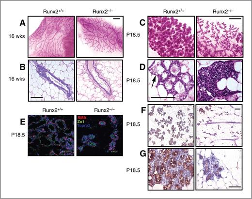 Runx2 Is a Novel Regulator of Mammary Epithelial Cell Fate in ...