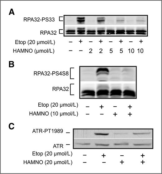 RPA Inhibition Increases Replication Stress and Suppresses Tumor Growth ...
