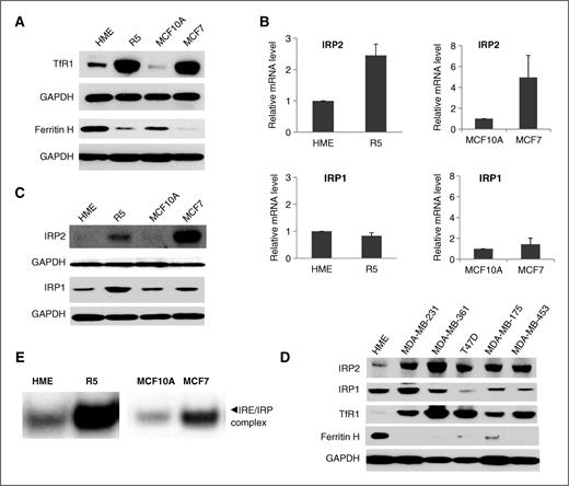 IRP2 Regulates Breast Tumor Growth | Cancer Research | American ...