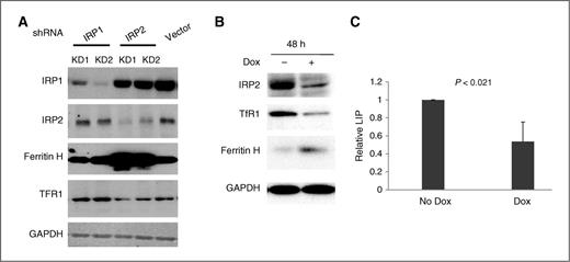 IRP2 Regulates Breast Tumor Growth | Cancer Research | American ...