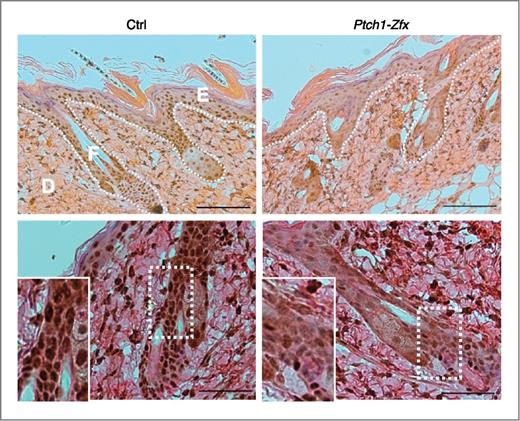Zfx Facilitates Tumorigenesis Caused by Activation of the Hedgehog ...