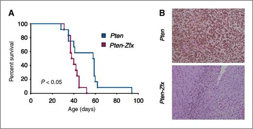 Zfx Facilitates Tumorigenesis Caused by Activation of the Hedgehog ...