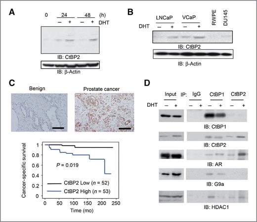 CtBP2 Modulates the Androgen Receptor to Promote Prostate Cancer ...