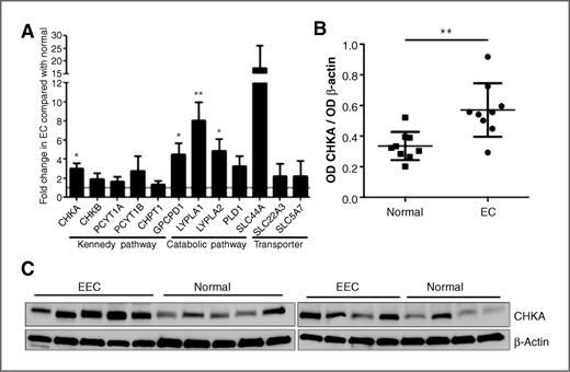Alterations of Choline Phospholipid Metabolism in Endometrial Cancer ...