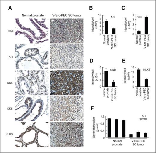 CCR5 Receptor Antagonists Block Metastasis to Bone of v-Src Oncogene ...