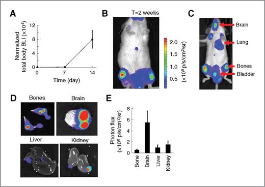 CCR5 Receptor Antagonists Block Metastasis to Bone of v-Src Oncogene ...