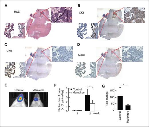 CCR5 Receptor Antagonists Block Metastasis to Bone of v-Src Oncogene ...