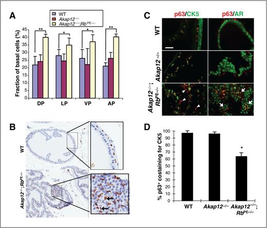 A Transgenic Mouse Model for Early Prostate Metastasis to Lymph Nodes ...