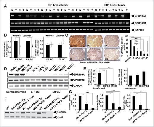 The Niacin/Butyrate Receptor GPR109A Suppresses Mammary Tumorigenesis ...