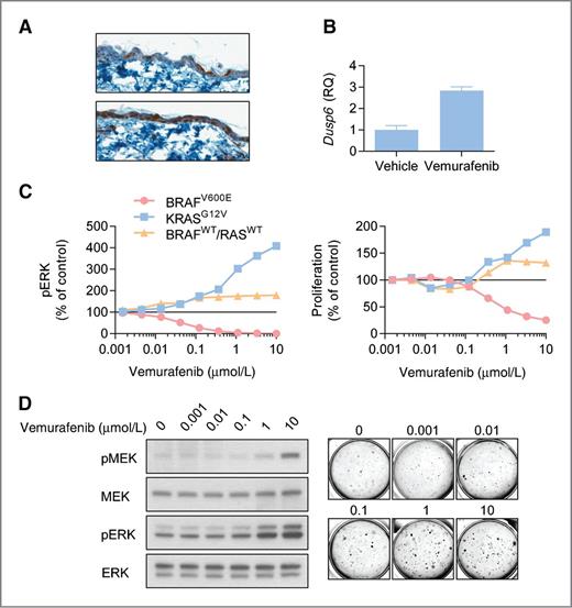 Vemurafenib Cooperates with HPV to Promote Initiation of Cutaneous ...