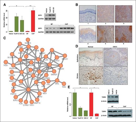 A Systems Biology Approach Identifies Effective Tumor–Stroma Common ...