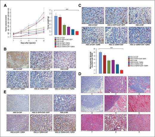 A Systems Biology Approach Identifies Effective Tumor–Stroma Common ...