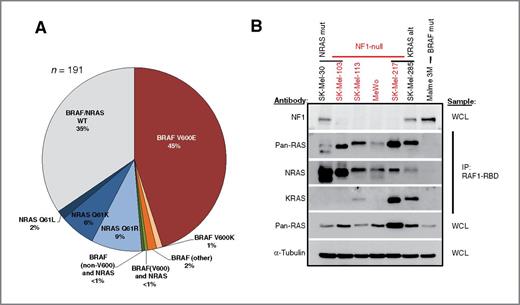 Loss of NF1 in Cutaneous Melanoma Is Associated with RAS Activation and ...