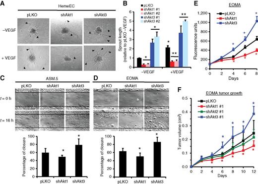 Akt1 and Akt3 Exert Opposing Roles in the Regulation of Vascular Tumor ...