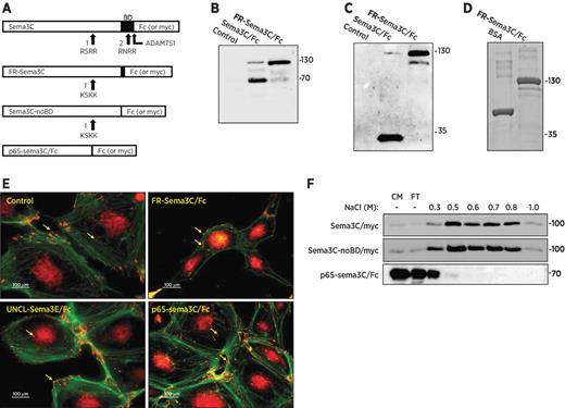 Full-Length Semaphorin-3C Is an Inhibitor of Tumor Lymphangiogenesis ...