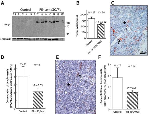 Full-Length Semaphorin-3C Is an Inhibitor of Tumor Lymphangiogenesis ...