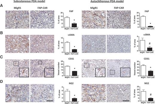 Tumor-Promoting Desmoplasia Is Disrupted by Depleting FAP-Expressing ...