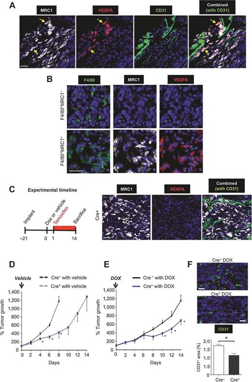 Perivascular M2 Macrophages Stimulate Tumor Relapse after Chemotherapy ...