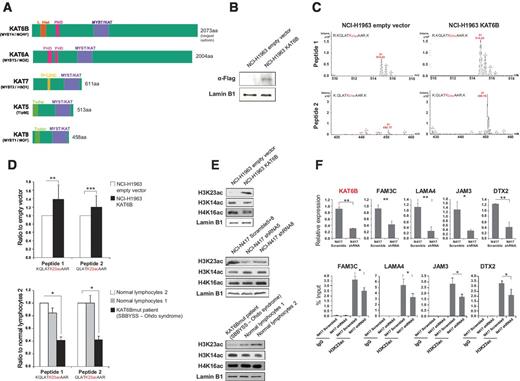 KAT6B Is a Tumor Suppressor Histone H3 Lysine 23 Acetyltransferase ...
