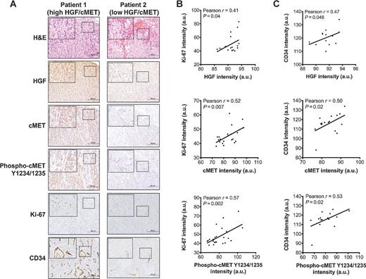 Hepatocyte Growth Factor/cMET Pathway Activation Enhances Cancer ...