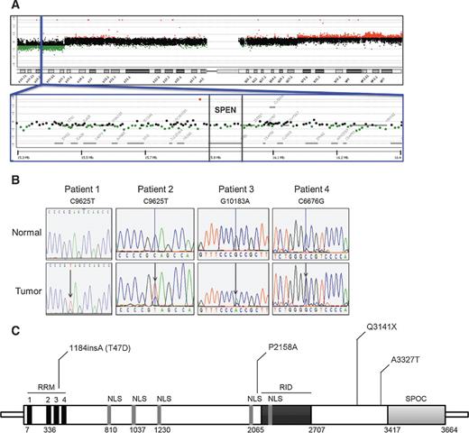 The Estrogen Receptor Cofactor SPEN Functions as a Tumor Suppressor and ...
