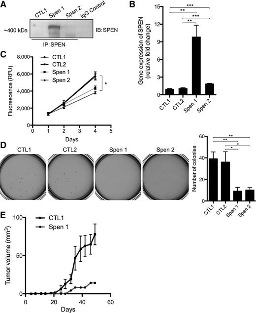 The Estrogen Receptor Cofactor SPEN Functions as a Tumor Suppressor and ...