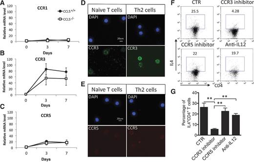 CCL5-Mediated Th2 Immune Polarization Promotes Metastasis in Luminal ...