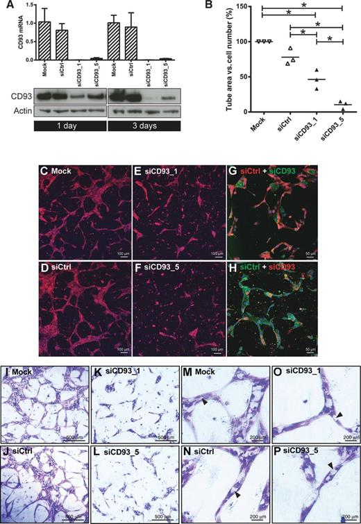 Elevated Expression of the C-Type Lectin CD93 in the Glioblastoma ...