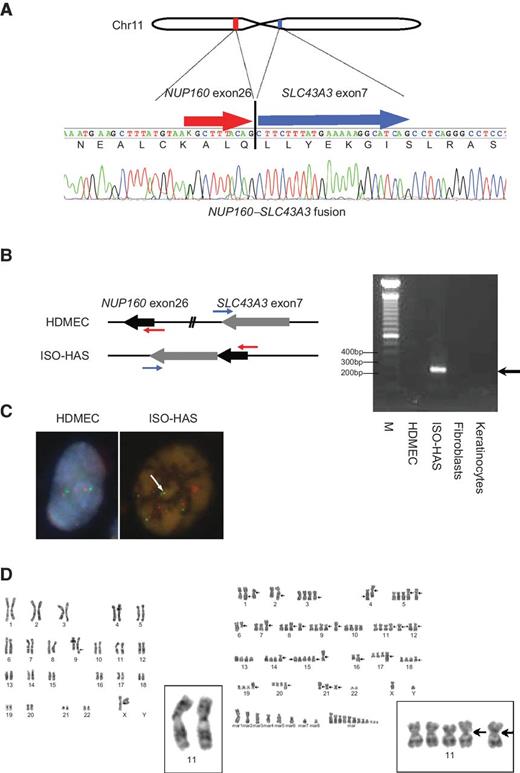 NUP160–SLC43A3 Is a Novel Recurrent Fusion Oncogene in Angiosarcoma ...
