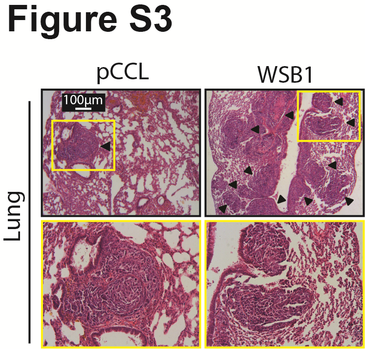 Hypoxia-Induced WSB1 Promotes the Metastatic Potential of Osteosarcoma ...