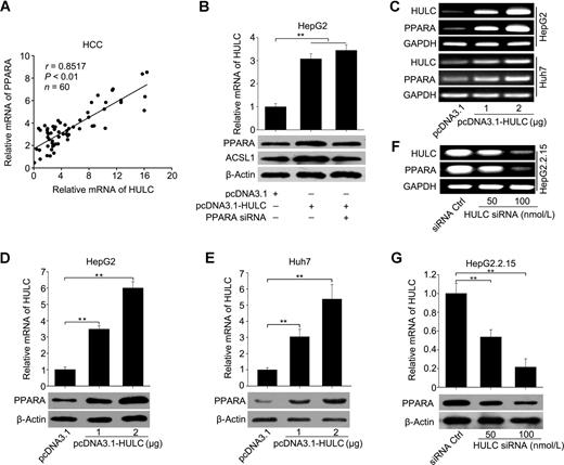 Long Noncoding RNA HULC Modulates Abnormal Lipid Metabolism in Hepatoma ...