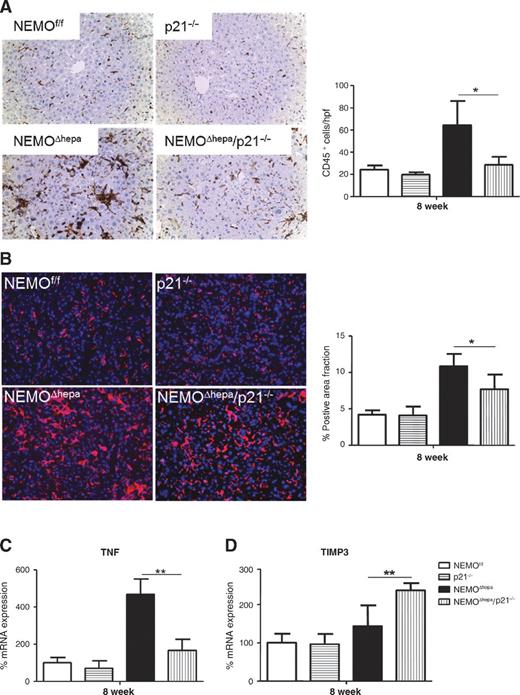 p21 Ablation in Liver Enhances DNA Damage, Cholestasis, and ...