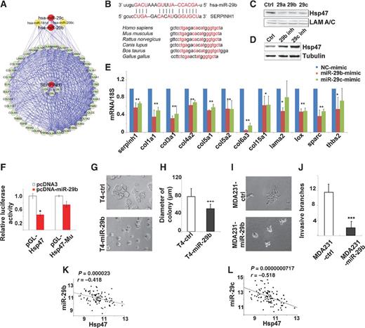 Chaperone Hsp47 Drives Malignant Growth and Invasion by Modulating an ...