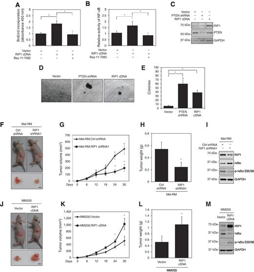RIP1 Kinase Is an Oncogenic Driver in Melanoma | Cancer Research ...