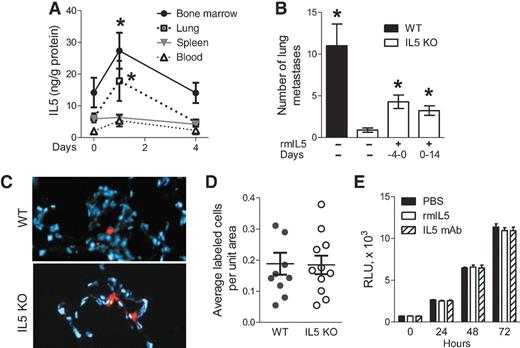 Interleukin-5 Facilitates Lung Metastasis by Modulating the Immune ...