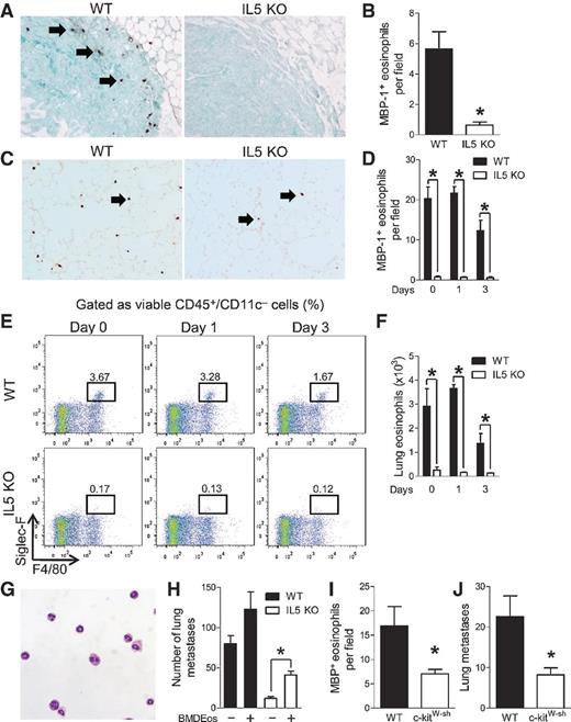 Interleukin-5 Facilitates Lung Metastasis by Modulating the Immune ...