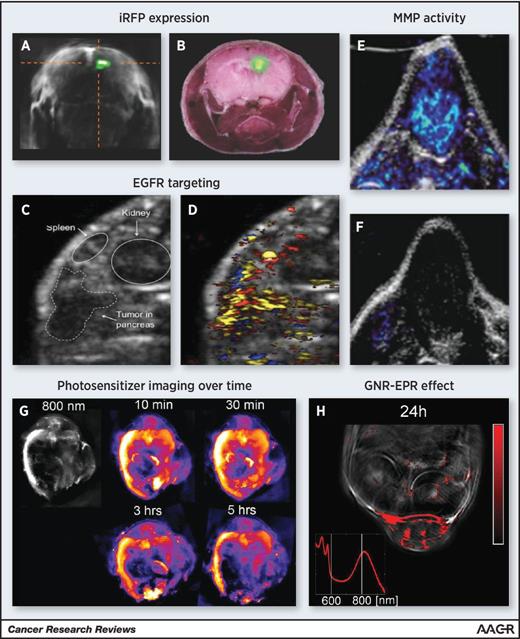 Mesoscopic and Macroscopic Optoacoustic Imaging of Cancer | Cancer ...