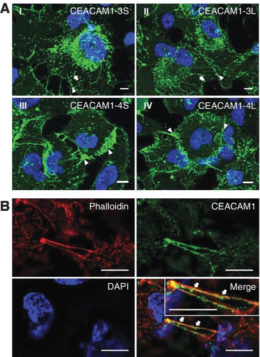 CEACAM1-3S Drives Melanoma Cells into NK Cell-Mediated Cytolysis and ...