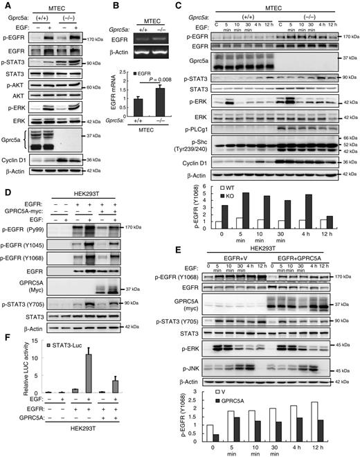 Lung Tumor Suppressor GPRC5A Binds EGFR and Restrains Its Effector ...