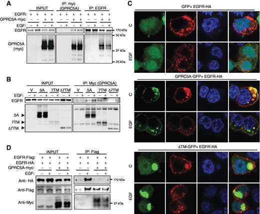 Lung Tumor Suppressor GPRC5A Binds EGFR and Restrains Its Effector ...