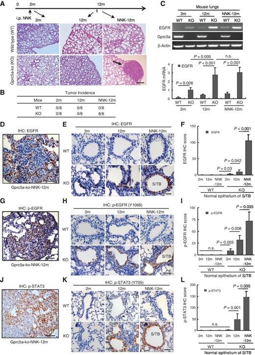 Lung Tumor Suppressor GPRC5A Binds EGFR and Restrains Its Effector ...