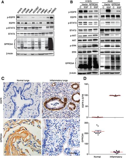 Lung Tumor Suppressor GPRC5A Binds EGFR and Restrains Its Effector ...