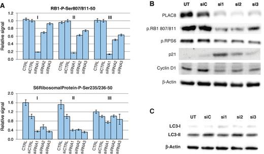 PLAC8 Localizes to the Inner Plasma Membrane of Pancreatic Cancer Cells ...
