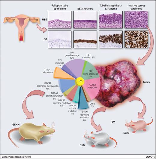It's Totally Tubular…Riding The New Wave of Ovarian Cancer Research ...