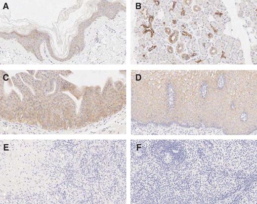 Enfortumab Vedotin Antibody–Drug Conjugate Targeting Nectin-4 Is a ...